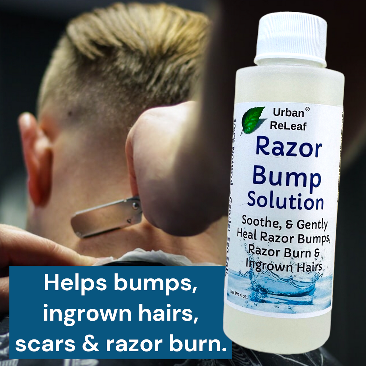 Razor Bump Solution – Urban ReLeaf